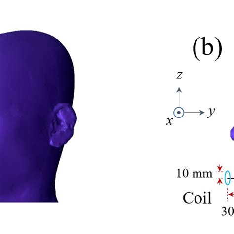 Demonstration Of Tms Coil Positioning For Brain Stimulation A And