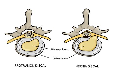 Althea Fisioterapia Avanzada