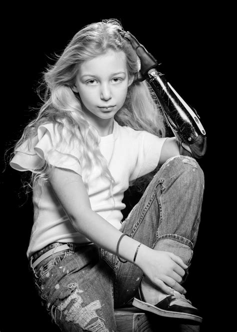 Roxy D Zbd Talent Models With Disabilities Visible Differences