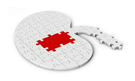 신장의 모양의 퍼즐 조각 흰색 배경에 고립 된 신장 모양의 직소 3d 그림 사람 콩팥에 대한 스톡 사진 및 기타 이미지 사람 콩팥 지그소 퍼즐 콩팥 내부 기관