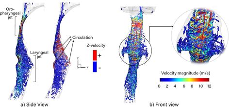 Vortex Structures In The Mouth Throat Airway Visualized By Q Criterion