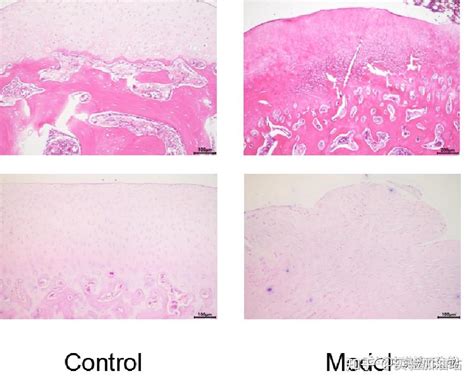 诱发性骨性关节炎模型（oa） 知乎