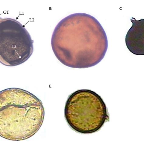 Root Colonization By Arbuscular Mycorrhizal Fungi Funneliformis Download Scientific Diagram