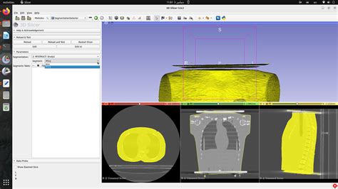 Displaying Segments Of A Specific Segmentation In The