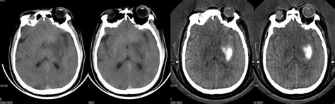 影像学新利器——能谱ct知多少 庆阳市人民医院