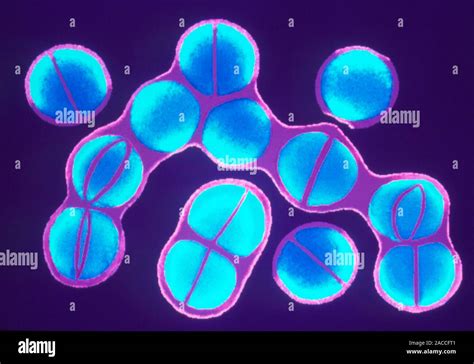 Staphylococcus Bacteria Coloured Transmission Electron Micrograph Tem Of Staphylococcus