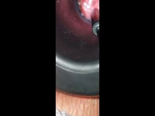 使用内窥镜摄像头进行肛门检查 Pornhub