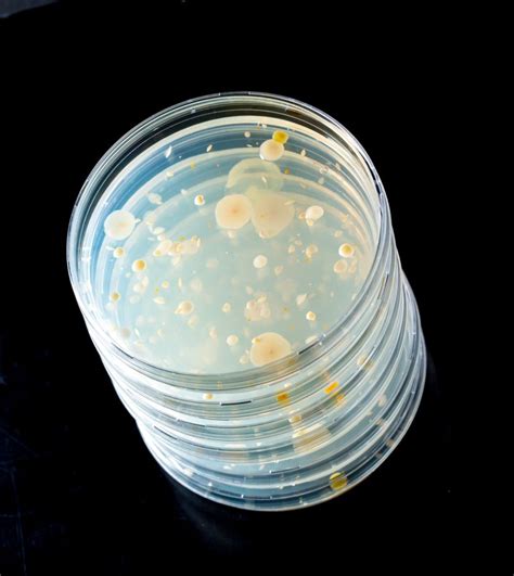 Learn About Microbial Health With Total Viable Count Sysco