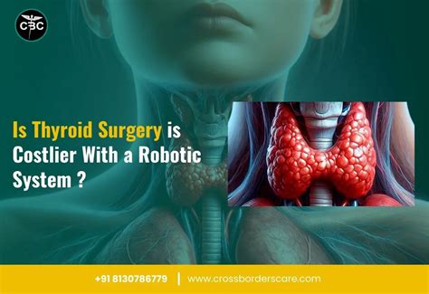Is Thyroid Surgery Costlier With A Robotic System