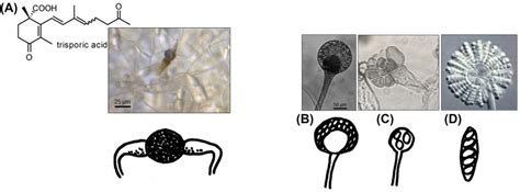 Major Morphological Structures Of The Zygomycetes A Zygospore And The