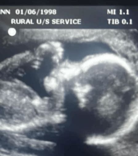 Maree And Rhiley Kuhrt Remembered After Qld Plane Crash