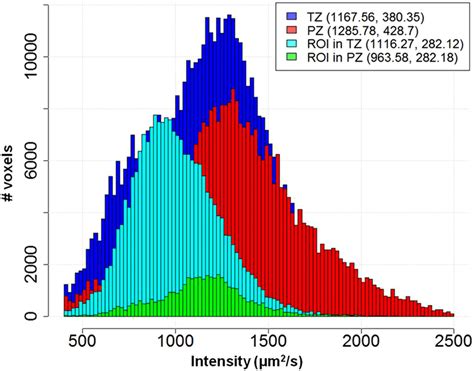 Histograms Of Adc Values In Transition Zone Tz Peripheral Zone Pz Download Scientific