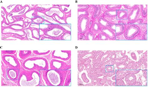 Figure 1 From Comparative Analysis Of Epididymis Cauda Of Yak Before