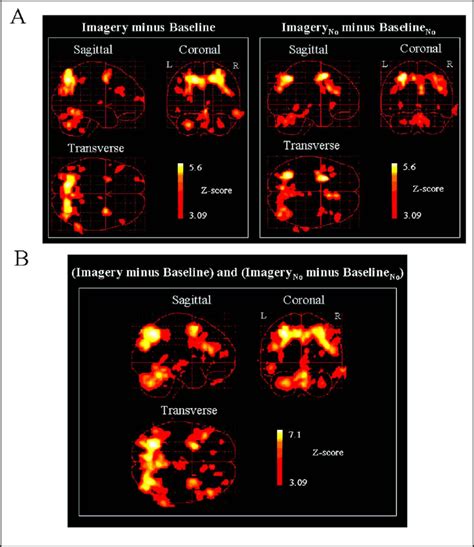 A Statistical Parametric Map Revealing The Areas That Were Activated Download Scientific
