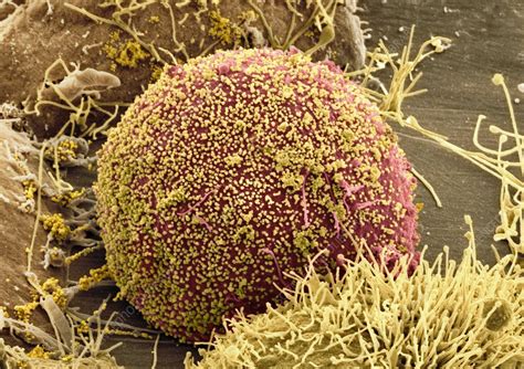 Cell Infected With Hiv Sem Stock Image C003 6043 Science Photo Library