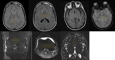 Mri Image Types Diagram Quizlet