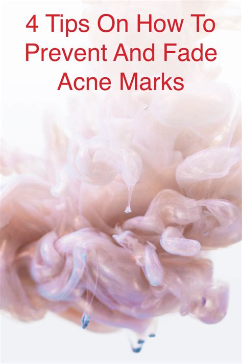 Tips On How To Prevent And Fade Acne Marks Kaneshon