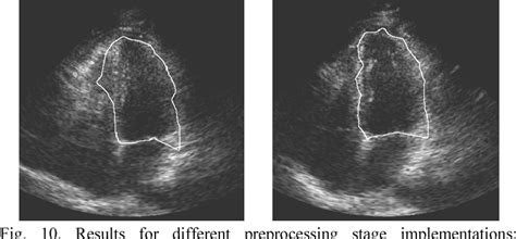 Figure 1 From Improved Segmentation Of Echocardiographic Images Using