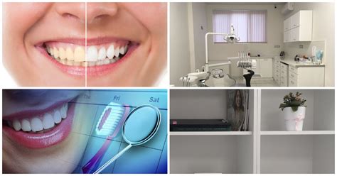 Клинично избелване на зъби преглед и план за цялостно лечение разграбена оферта 06 01 2023