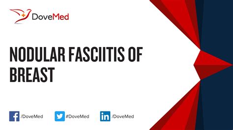 Nodular Fasciitis Of Breast