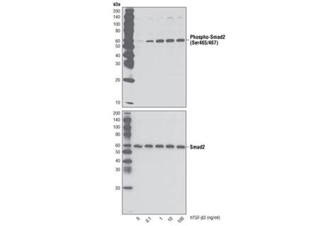 Human Transforming Growth Factor β3 Htgf β3 Cell Signaling Technology