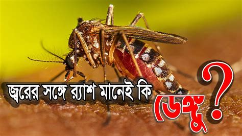 জ্বরের সঙ্গে র‍্যাশ মানেই কি ডেঙ্গু Dengue Fever ডেঙ্গু রোগের লক্ষণ কি কি ।।স্বাস্থ্য সেবা
