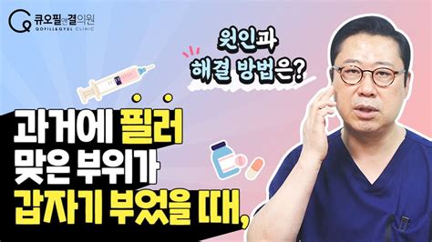 과거에 필러 맞은 부위가 갑자기 부었을 때 원인과 해결 방법은 Youtube