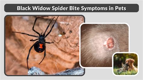 Black Widow Spider Bite Symptoms Signs Timeline And Treatment