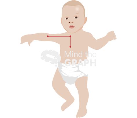 Free Pediatric Picc Traditional Method Measure Icons Symbols Pictures And Images Mind The Graph