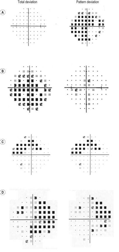The Visual Field Clinical Tree
