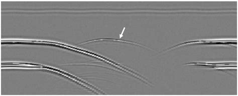 Case 2 Civa Simulation B Scan For Defect Of 2 Mm In Size At The