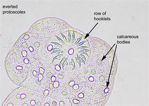 Creepy Dreadful Wonderful Parasites March 2019