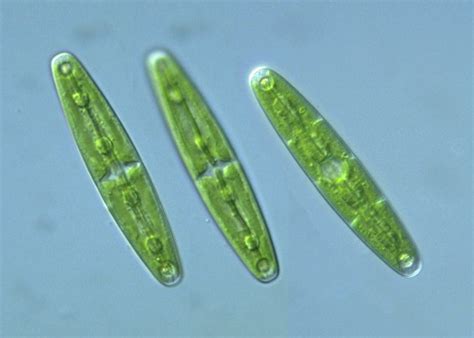 Protist Images Closterium Navicula