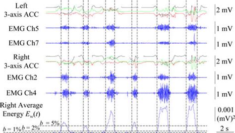Example Of The Segmentation Results Of A Csl Sentence Which Is Download Scientific Diagram