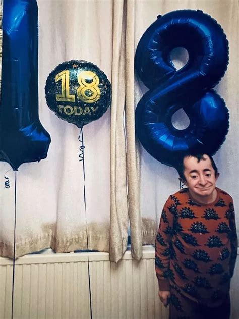 Benjamin Button Teen Mistaken For Middle Aged Man Due To Rare Genetic Condition HertsLive