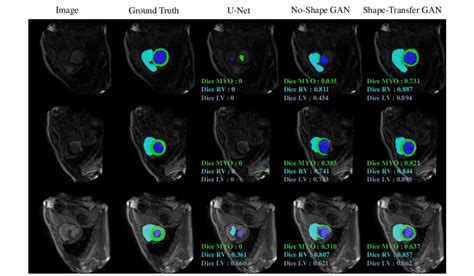 Segmentation Results Of Different Methods For Ablation Study Each Row