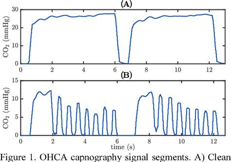 Figure 1 From A Simple Algorithm For Ventilation Detection In The