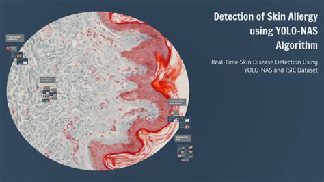 Detection Of Skin Allergy Using Yolo Nas Algorithm By 057 Srimathi K On Prezi