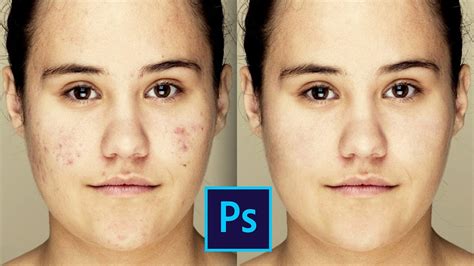 Как на фото убрать прыщи в фотошопе Как убрать прыщи в фотошопе Adobe