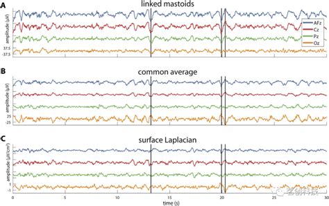 人类睡眠eeg分析：附代码实现的方法学入门实现eeg软件或硬件的某个功能 Csdn博客