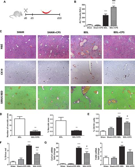 Effects Of Cps Diet On Bdl Induced Liver Injury A Schematic Overview