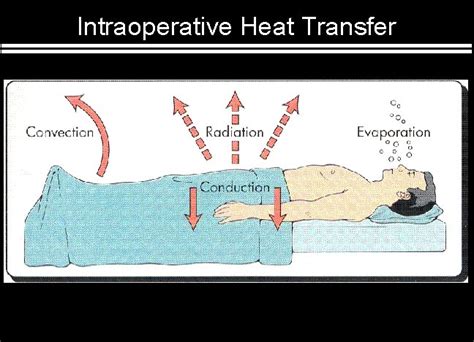 Department Of Outcomes Research Thermoregulation Heat Balance Thermoregulation