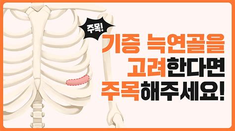 기증 늑연골의 장점은 네이버 Tv
