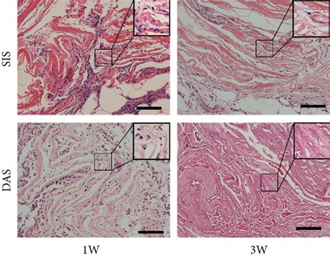 In Vivo Evaluation Of Immune Rejection And Inflammatory Response To Ecm Download Scientific