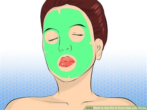 How To Get Rid Of Acne Fast With Honey Steps With Pictures