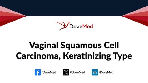 Vaginal Squamous Cell Carcinoma Keratinizing Type Dovemed