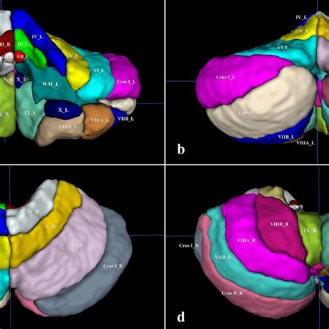 Three Dimensional 3d Visualization Of The Parcellation Of The Download Scientific Diagram