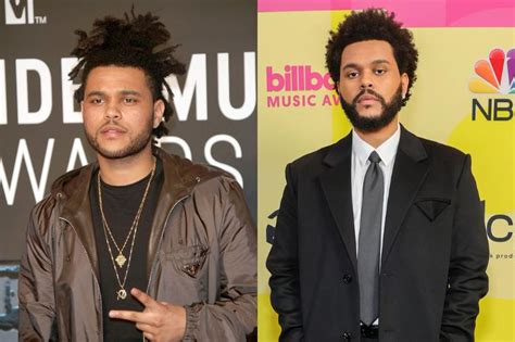 Did The Weeknd Get Plastic Surgery Ebrx