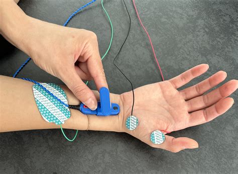 Emg électromyogramme Cabinet Dr Zied Affes Evry 91