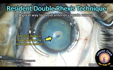 1240 Resident Double Rhexis Cataract Coach™